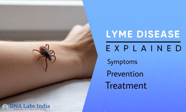 Lyme Disease Test in India – Symptoms, Neurological Lyme Disease ...